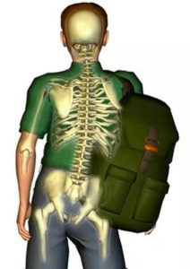 School Backpacks and Back Pain - Activate Physiotherapy
