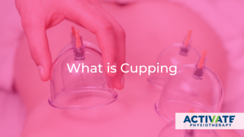What is Cupping? - Activate Physiotherapy